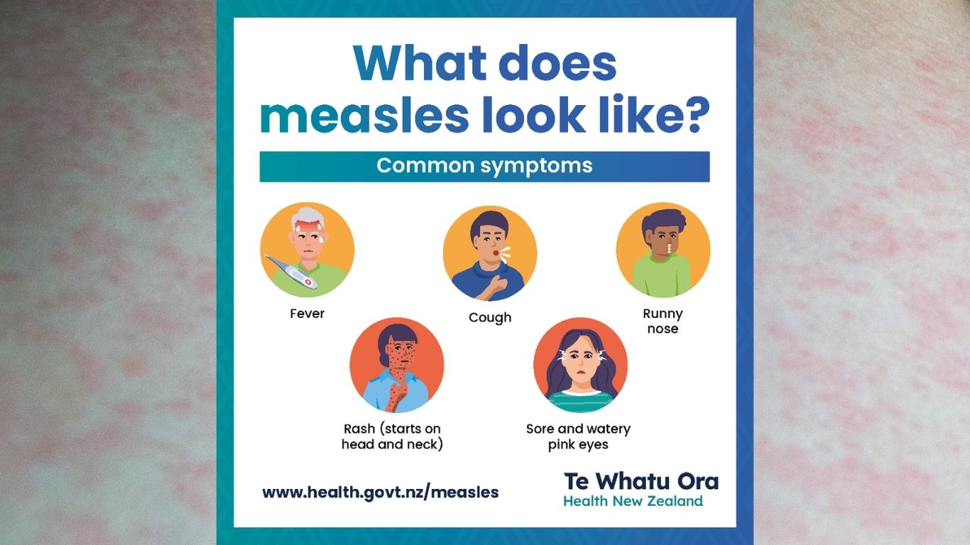 Measles - Green Bay High School